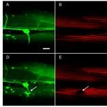 Laser dissection of neurons | ICFO