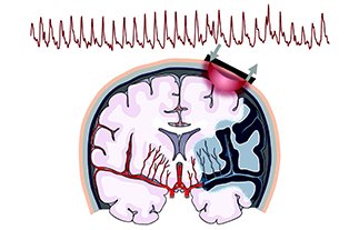 JONAS FISCHER | ICFO