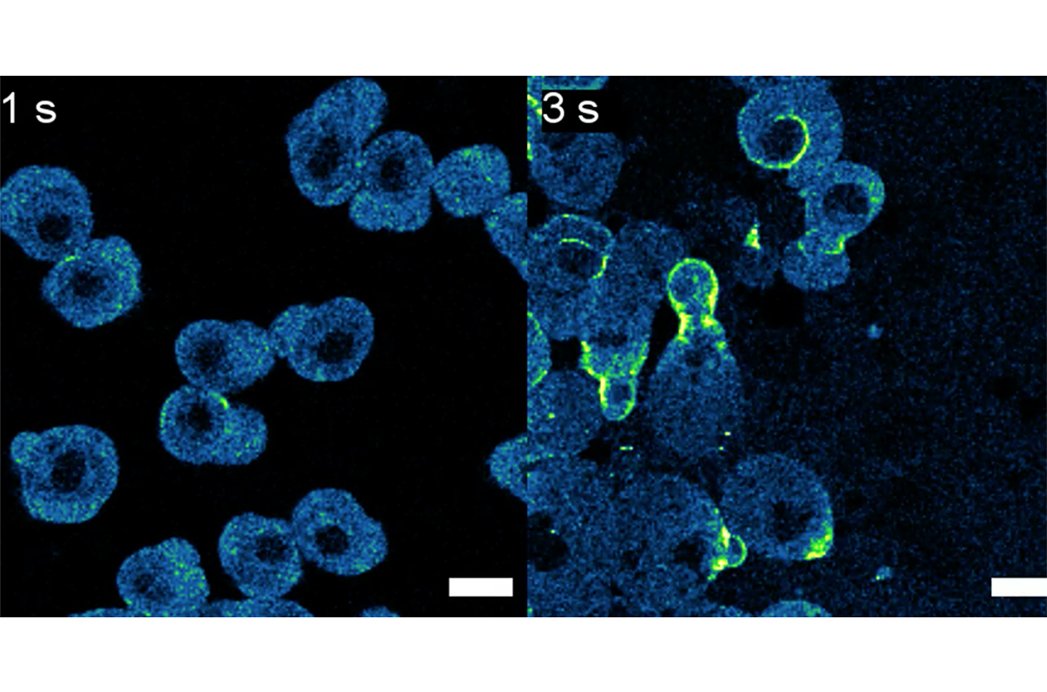 When feeling the pinch, nuclei instigate cells to escape crowded spaces ...